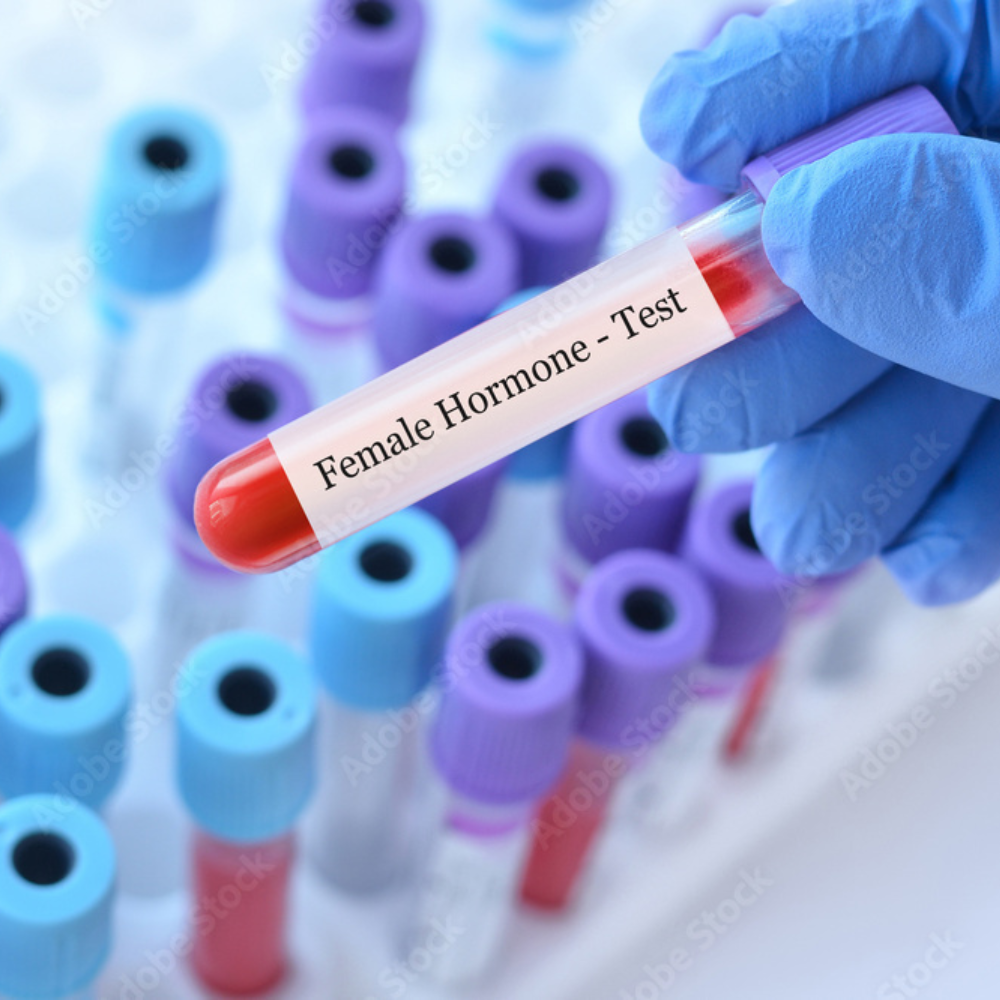 Fertility Testing - Dr Monique Atkinson